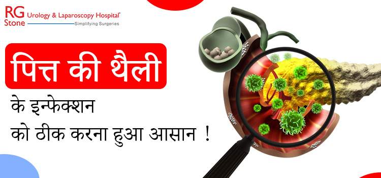 पित्त की थैली में इन्फेक्शन के क्या है कारण, लक्षण और इलाज